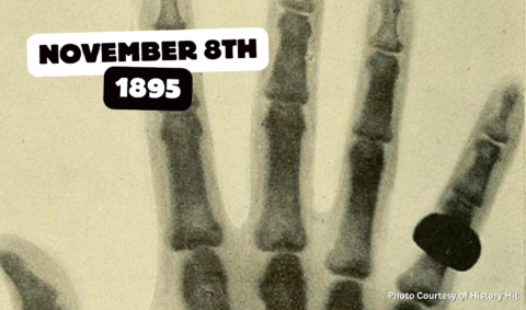 X-Rays Discovered By Accident in 1895 - Radiant History