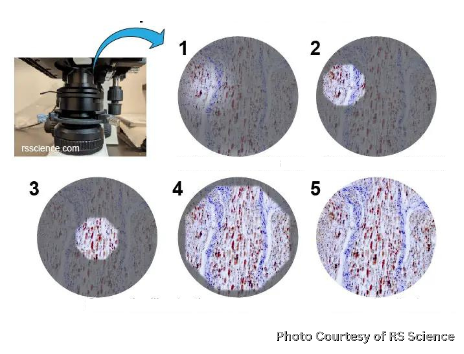 Refining Microscopy: Kohler Illumination - Radiant History