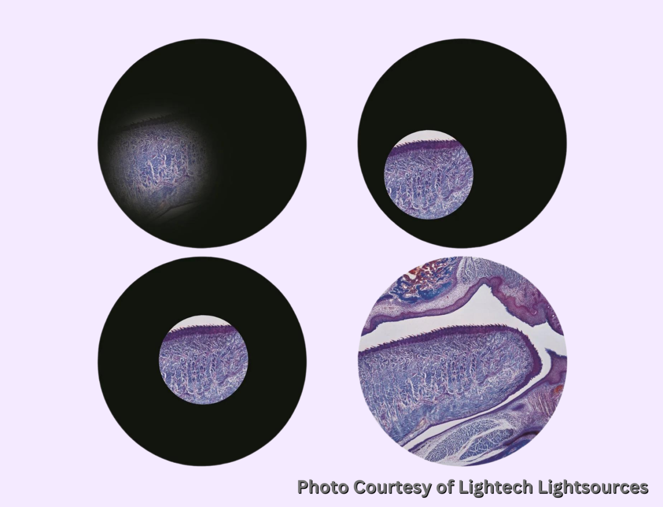 Refining Microscopy: Kohler Illumination - Radiant History